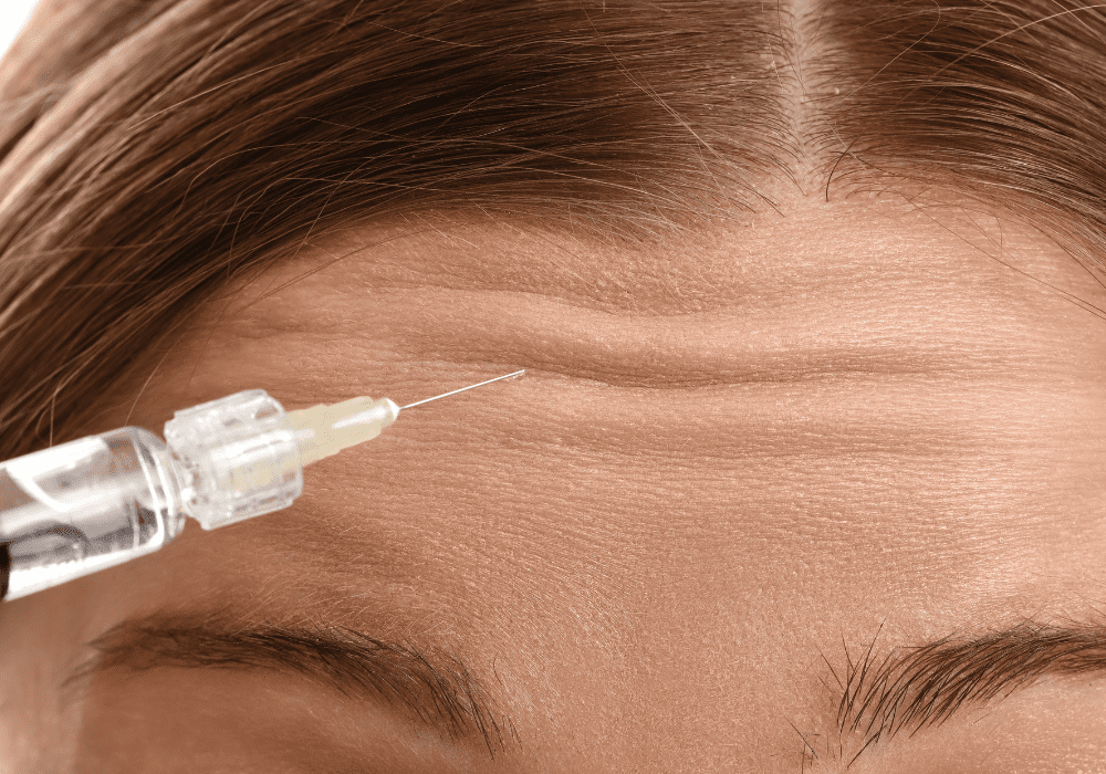 Forehead Filler London | Non-Surgical Forehead Filler